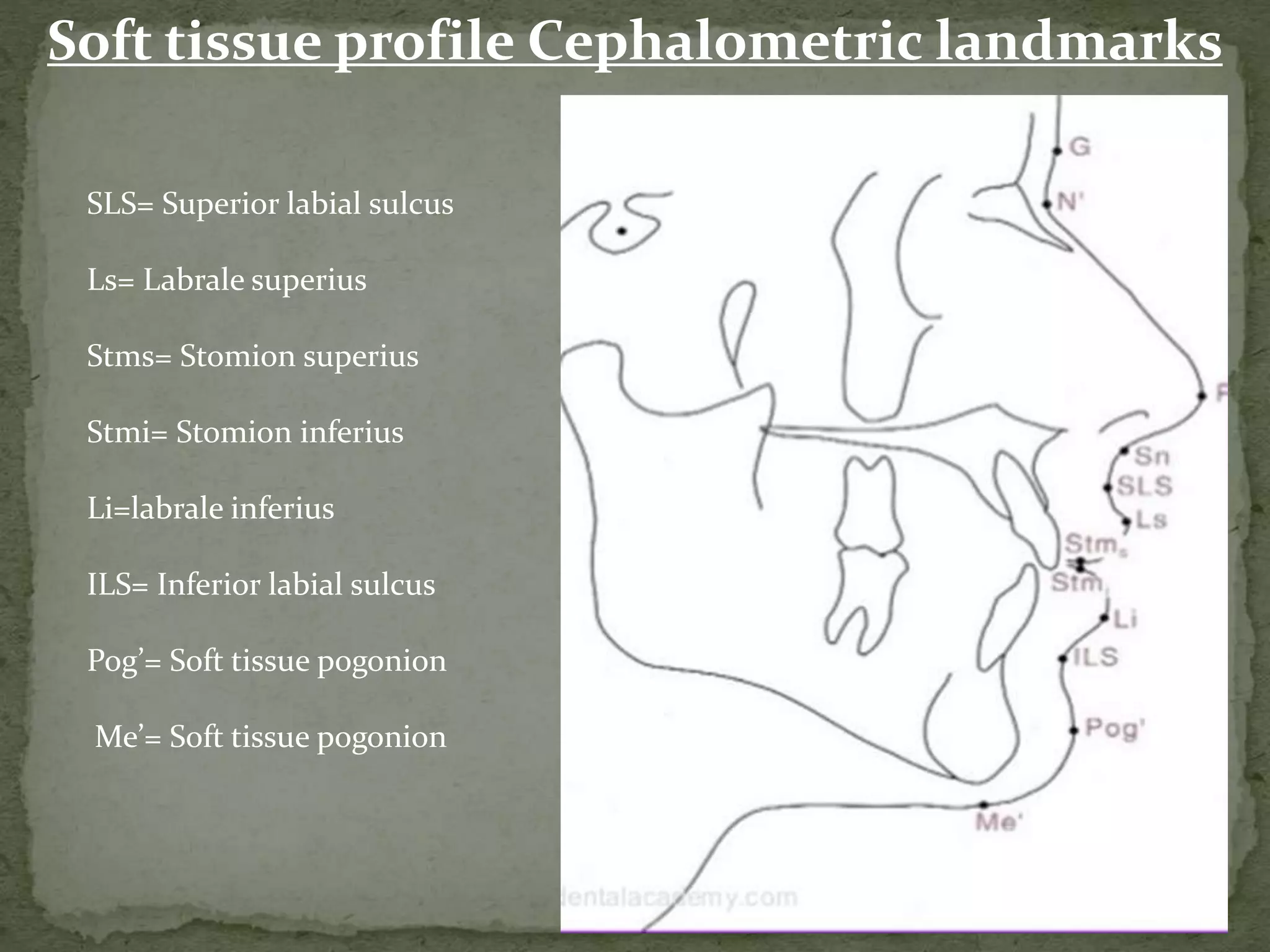 Soft tissue analysis | PPTX