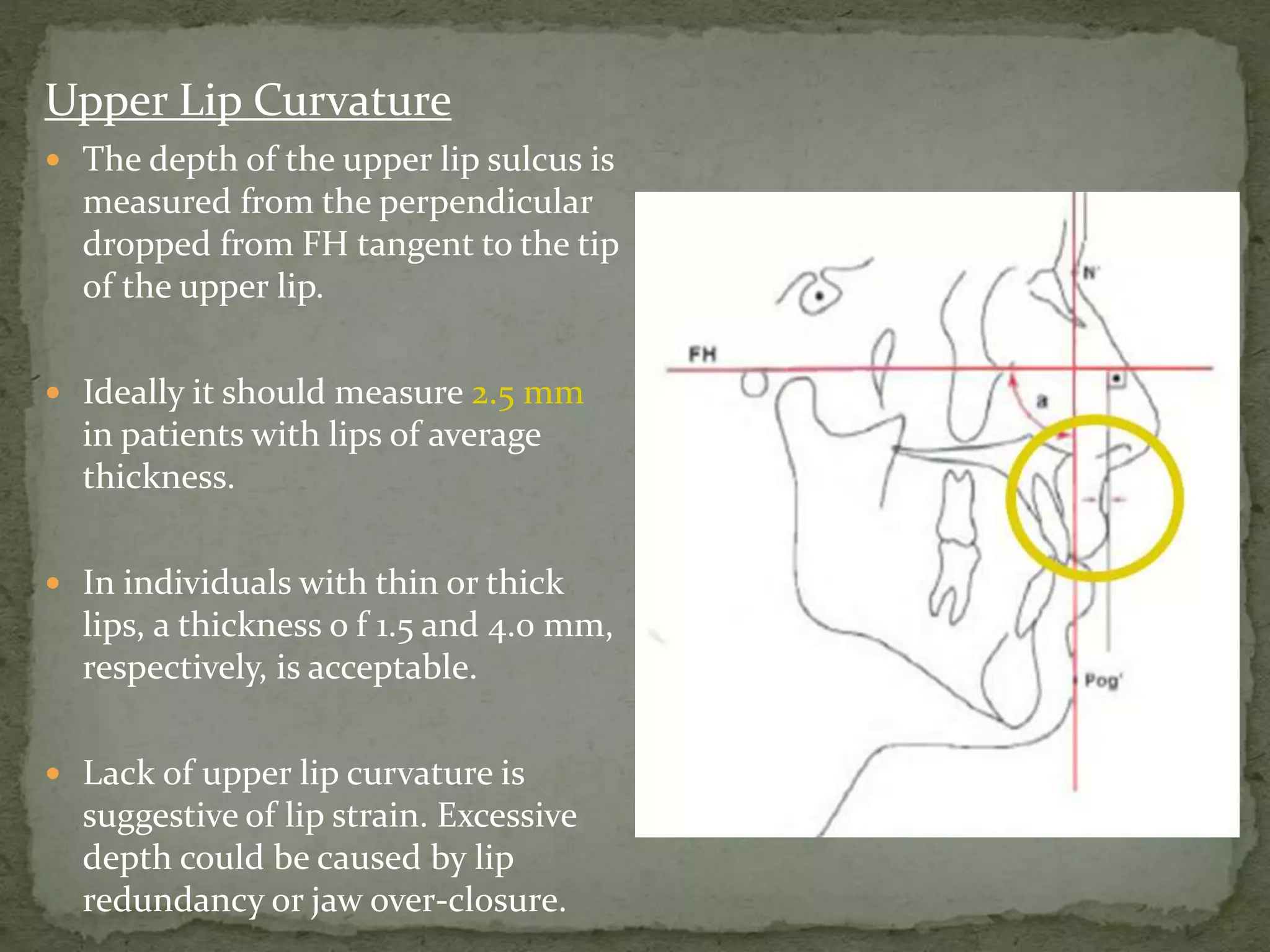 Soft tissue analysis | PPTX