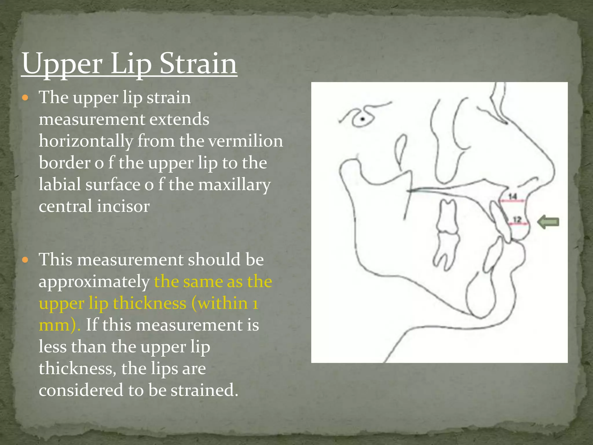 Soft tissue analysis | PPTX