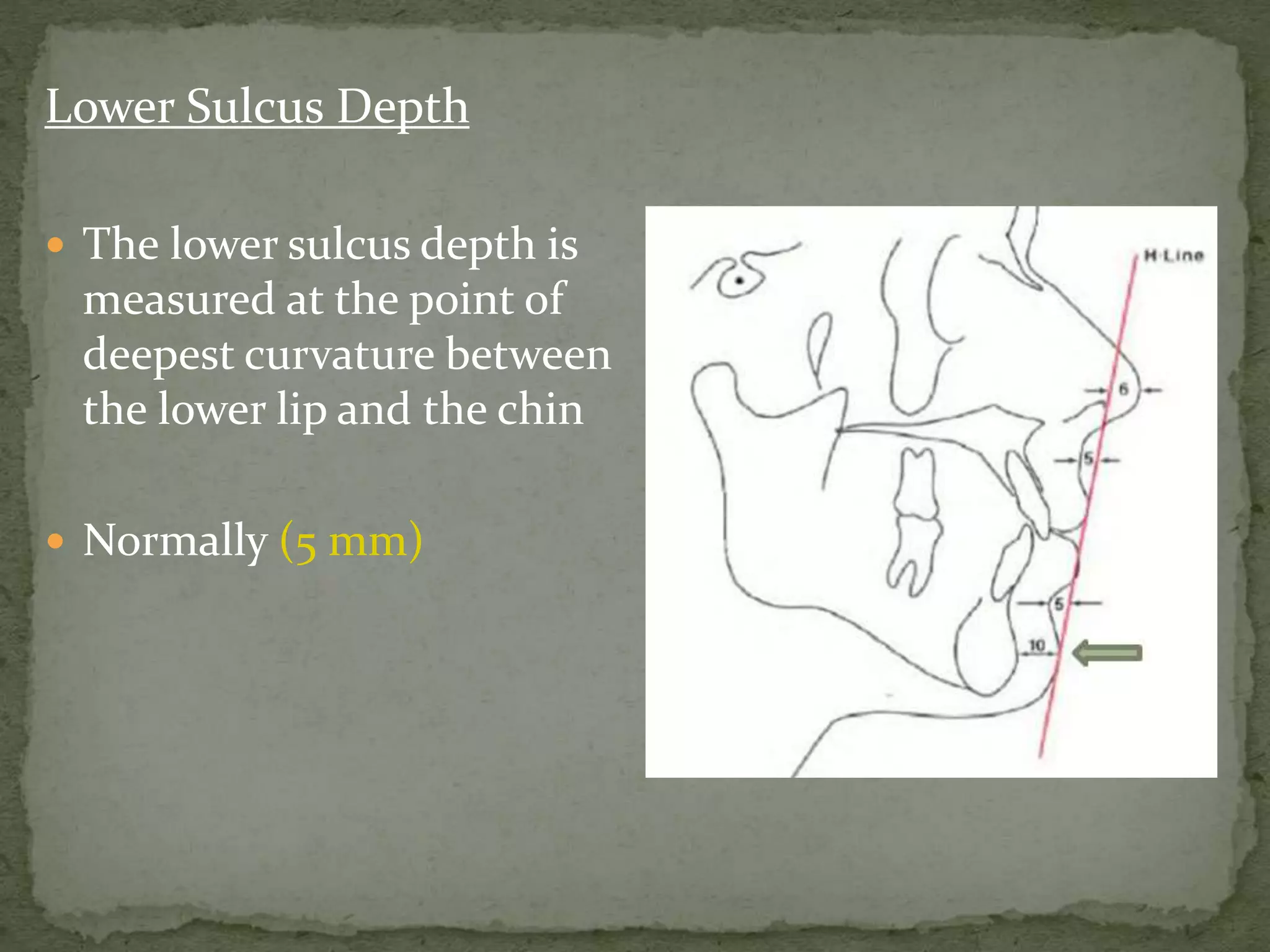 Soft tissue analysis | PPTX