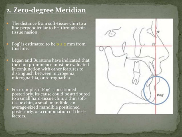 Soft tissue analysis | PPTX