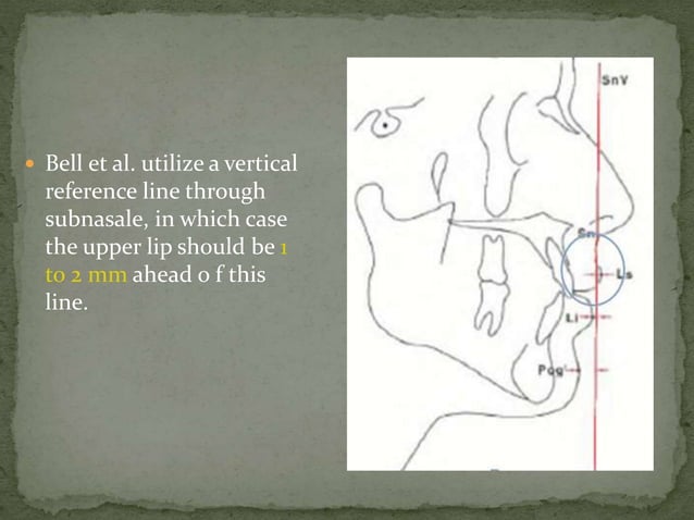 Soft tissue analysis | PPTX