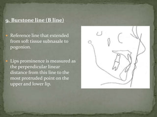 Soft tissue analysis | PPTX