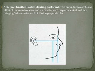 Soft tissue analysis | PPTX