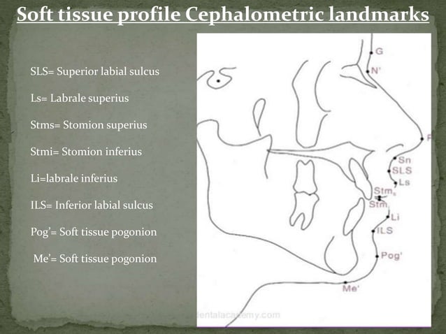 Soft tissue analysis | PPTX