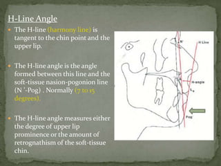 Soft tissue analysis | PPTX