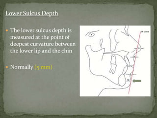 Soft tissue analysis | PPTX