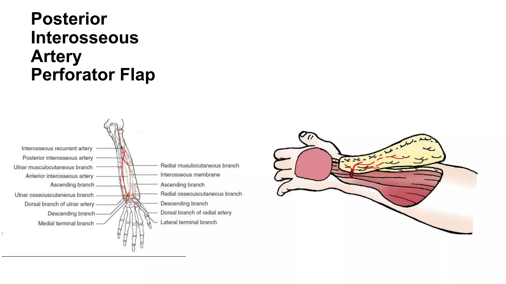 Soft tissue anatomy for hand flaps | PPTX
