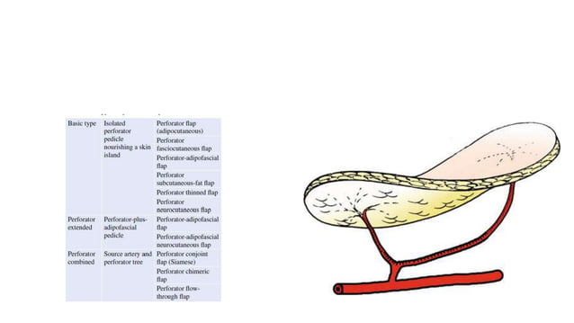 Soft tissue anatomy for hand flaps | PPTX