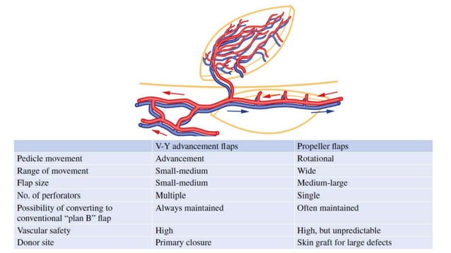 Soft tissue anatomy for hand flaps | PPTX