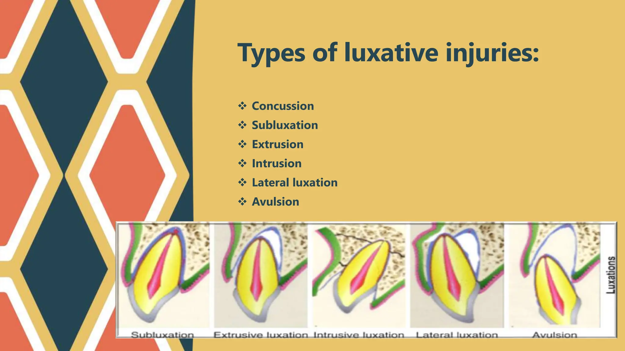 management of oral soft tissue injuries and luxation.pptx