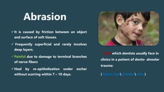 management of oral soft tissue injuries and luxation.pptx