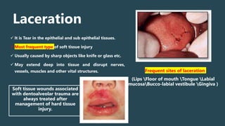management of oral soft tissue injuries and luxation.pptx