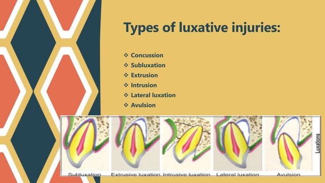 management of oral soft tissue injuries and luxation.pptx
