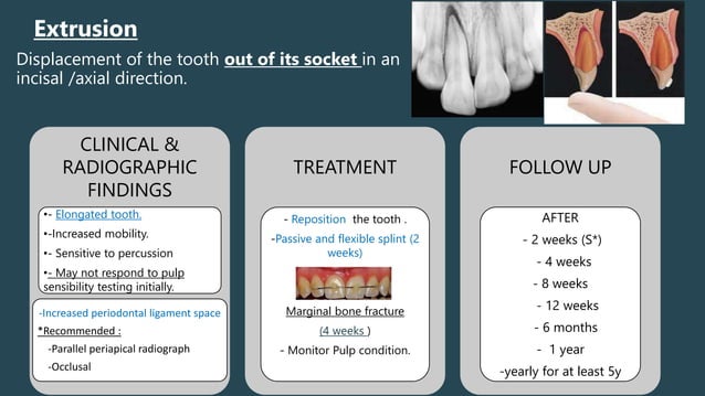 management of oral soft tissue injuries and luxation.pptx
