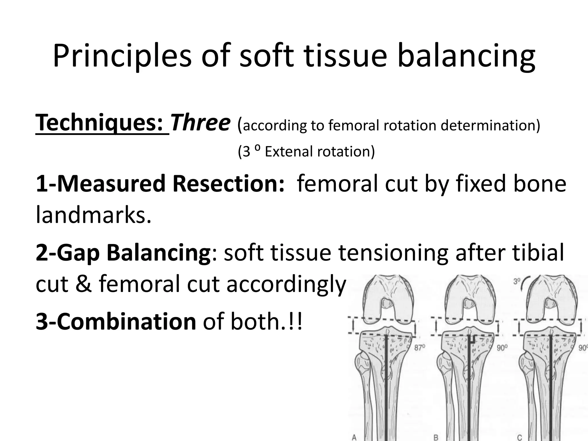 Soft Tissue Balancing in Primary Total Knee Arthroplasty | PPTX
