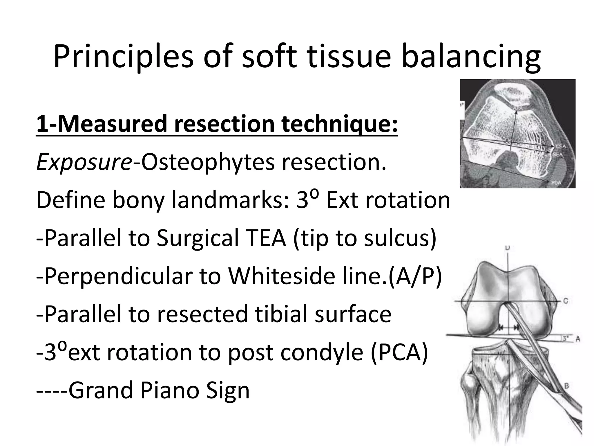 Soft Tissue Balancing in Primary Total Knee Arthroplasty | PPTX
