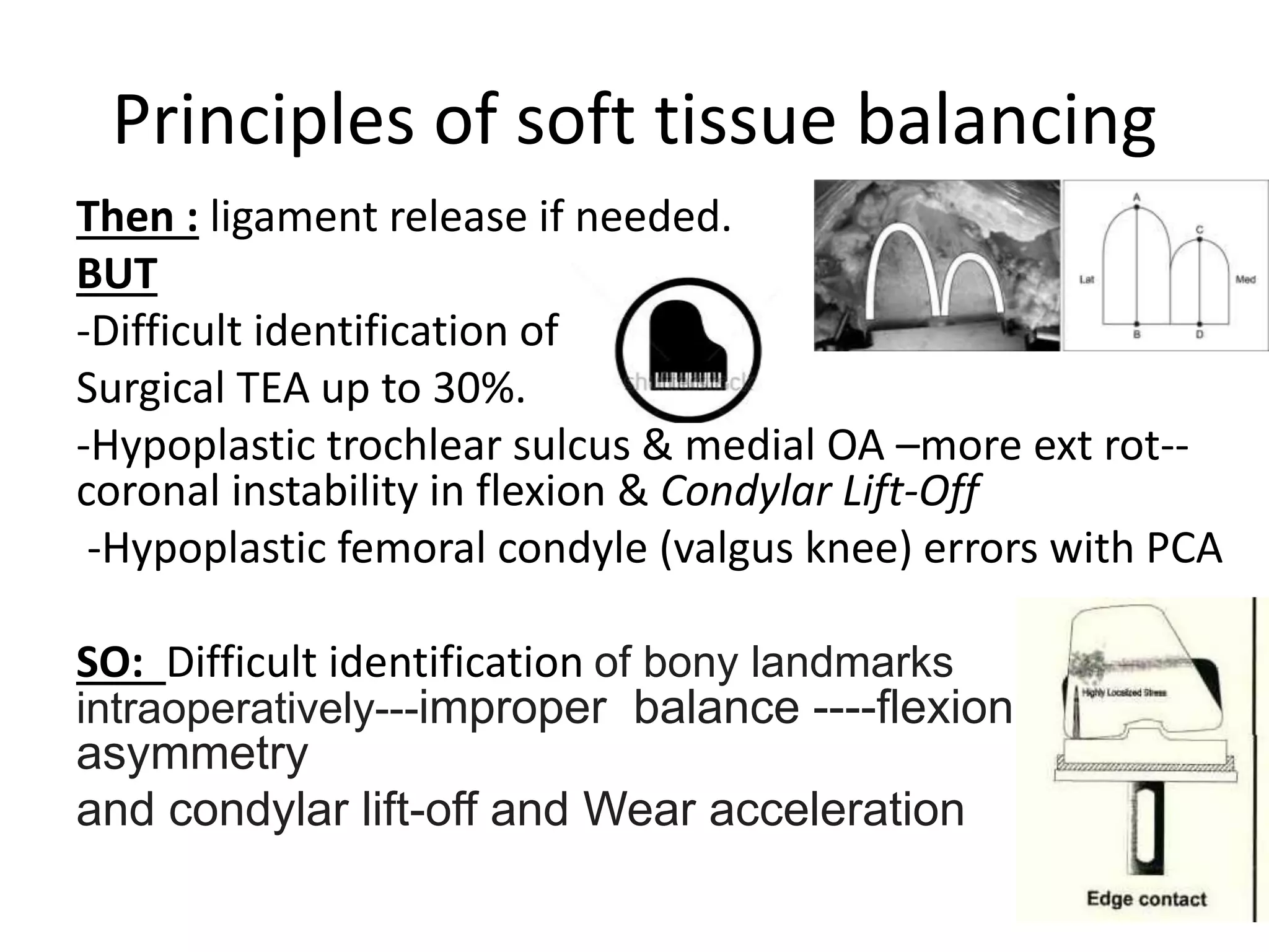 Soft Tissue Balancing in Primary Total Knee Arthroplasty | PPTX