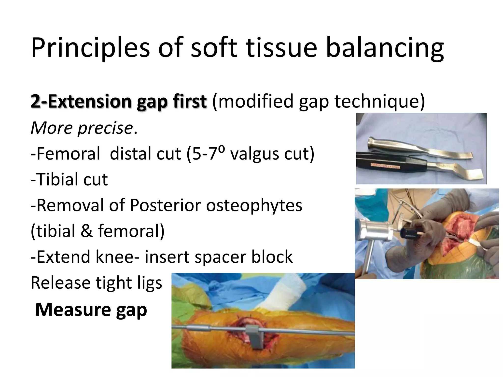 Soft Tissue Balancing in Primary Total Knee Arthroplasty | PPTX
