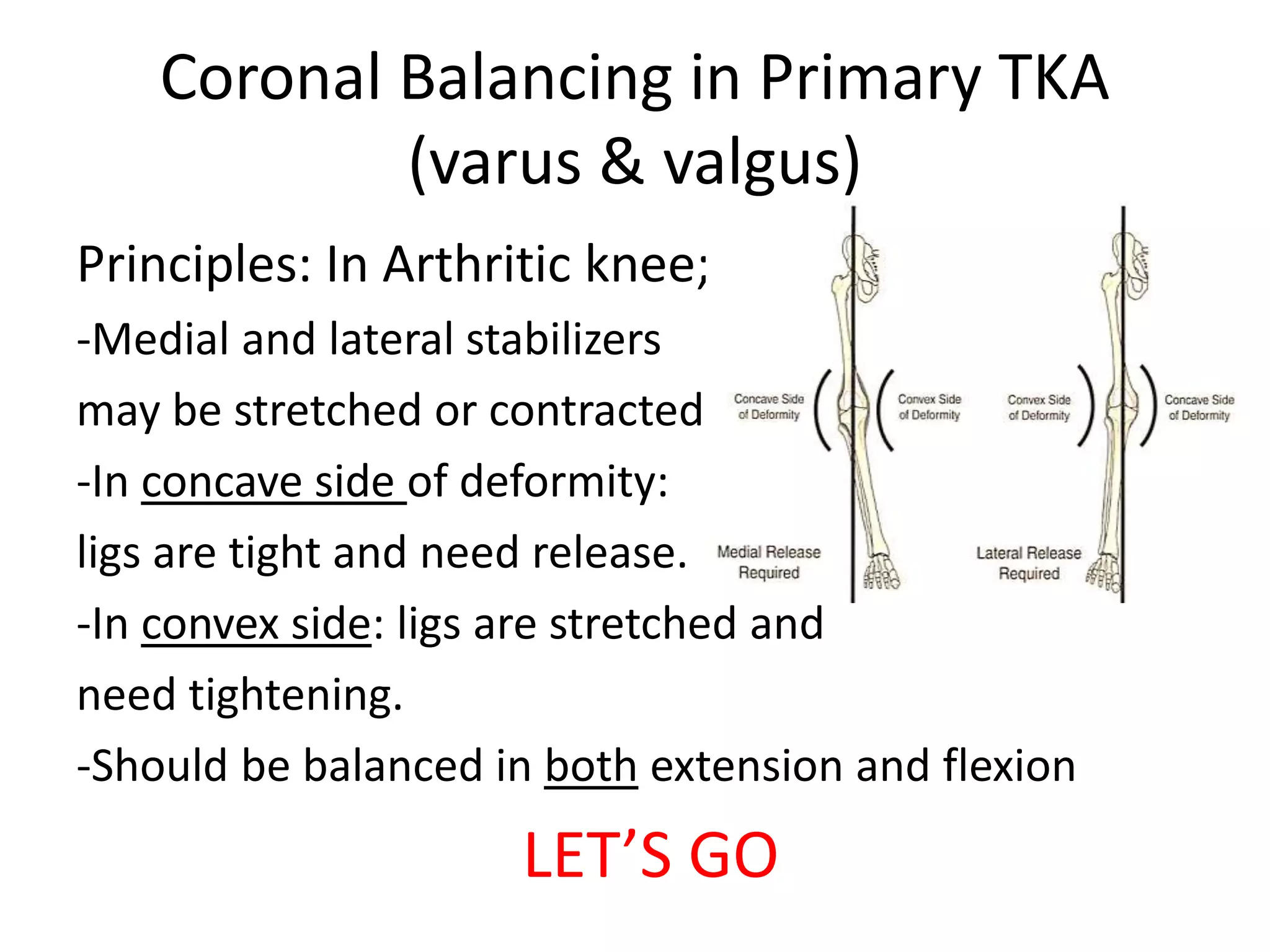 Soft Tissue Balancing in Primary Total Knee Arthroplasty | PPTX