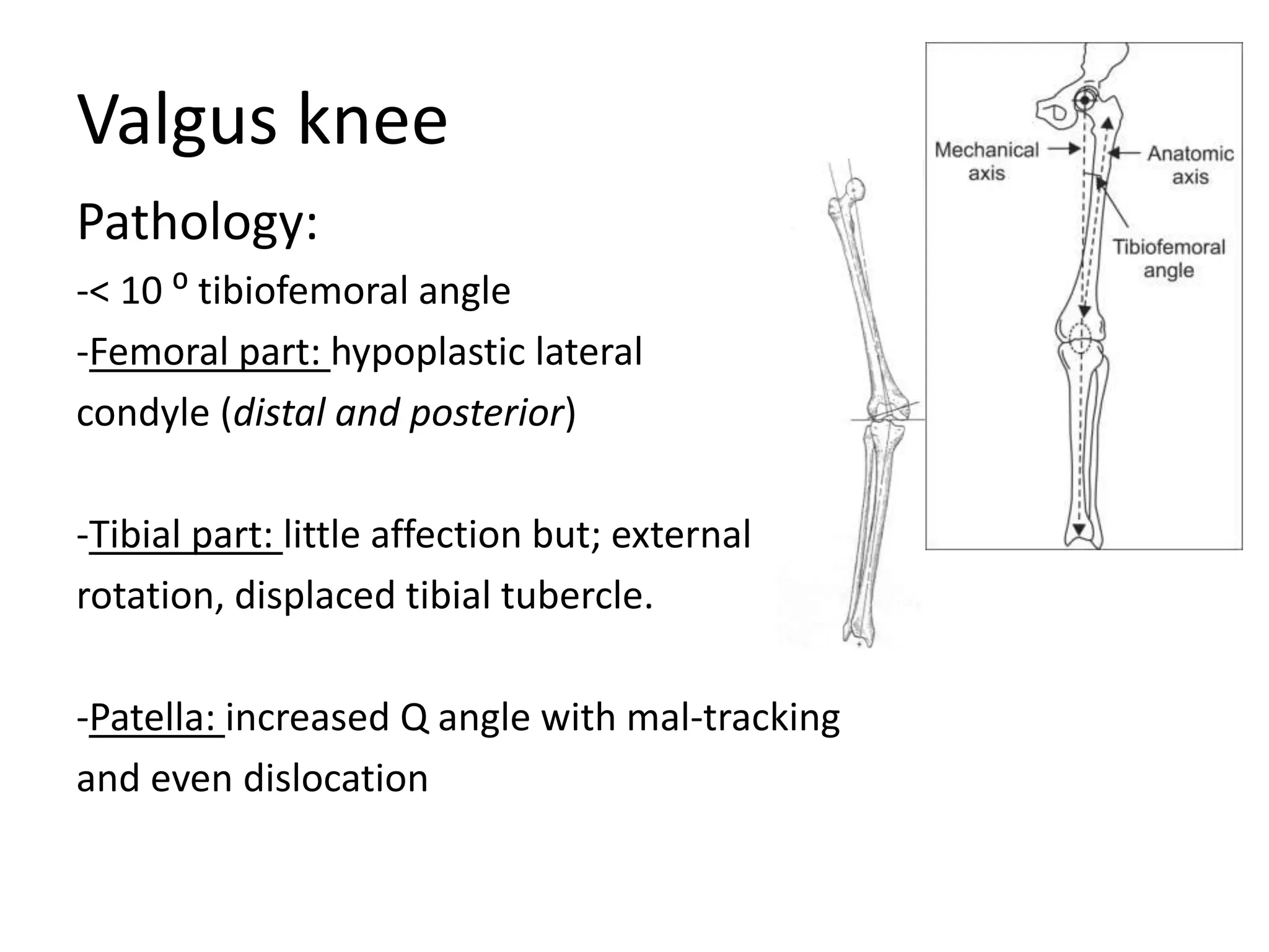 Soft Tissue Balancing in Primary Total Knee Arthroplasty | PPTX