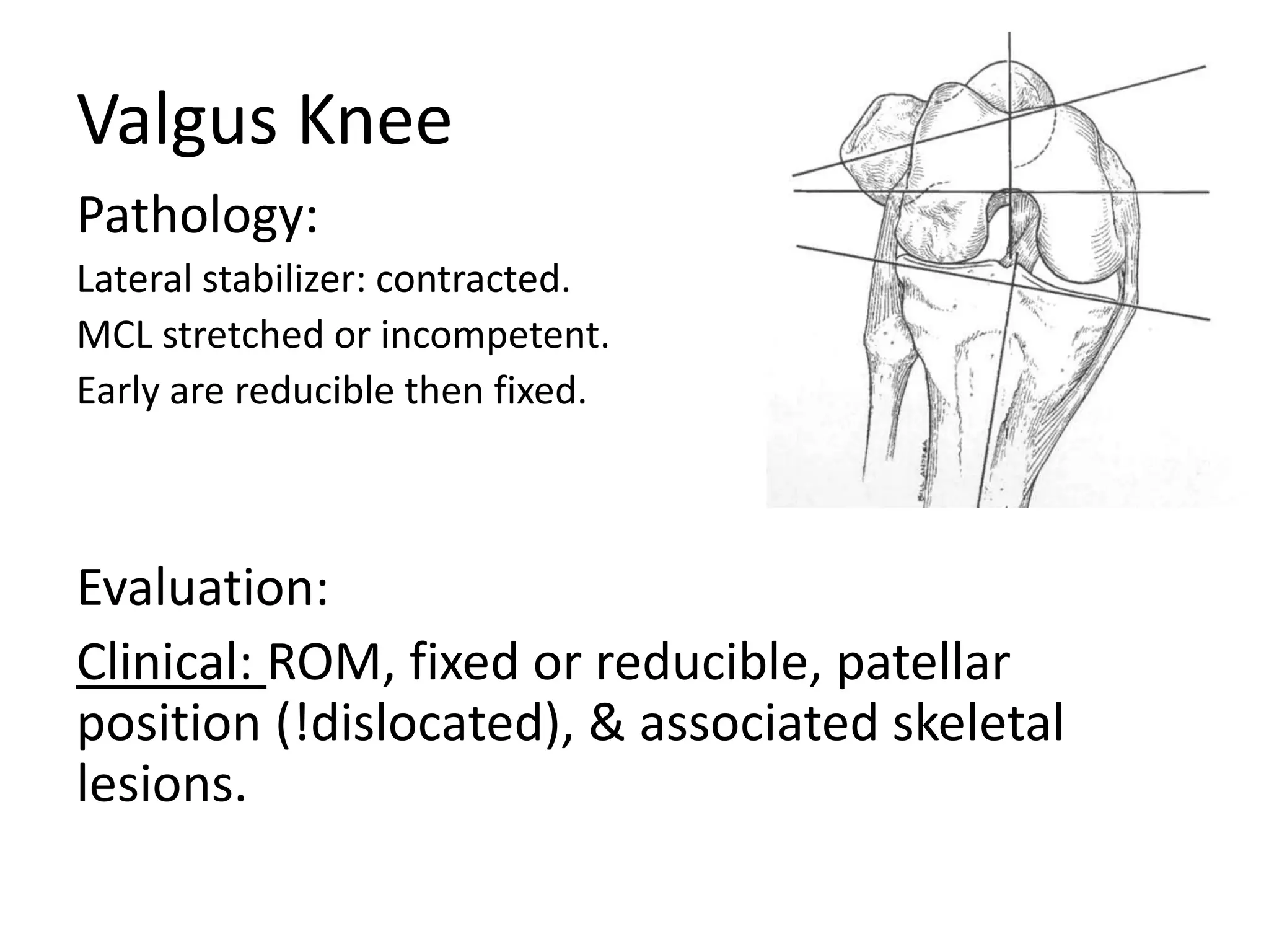 Soft Tissue Balancing in Primary Total Knee Arthroplasty | PPTX