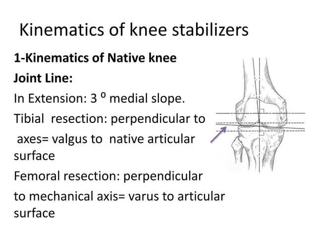 Soft Tissue Balancing in Primary Total Knee Arthroplasty | PPTX
