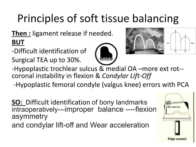 Soft Tissue Balancing in Primary Total Knee Arthroplasty | PPTX
