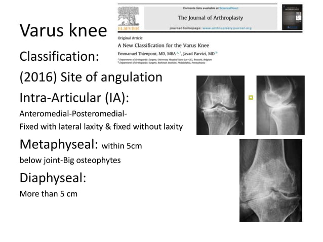 Soft Tissue Balancing in Primary Total Knee Arthroplasty | PPTX