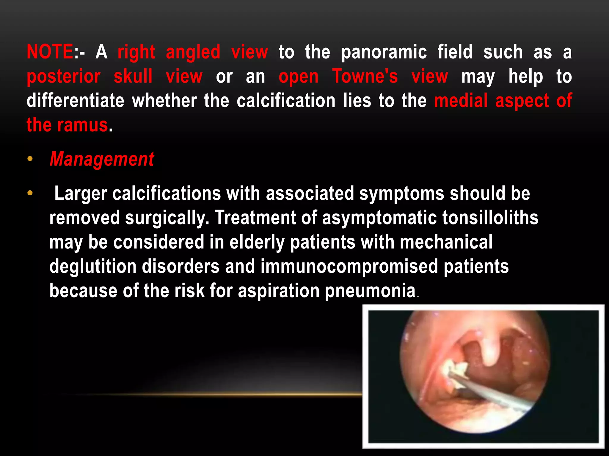 Soft tissue calcification orofacial region | PPTX