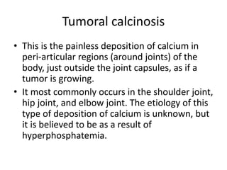 Soft tissue calcification | PPTX