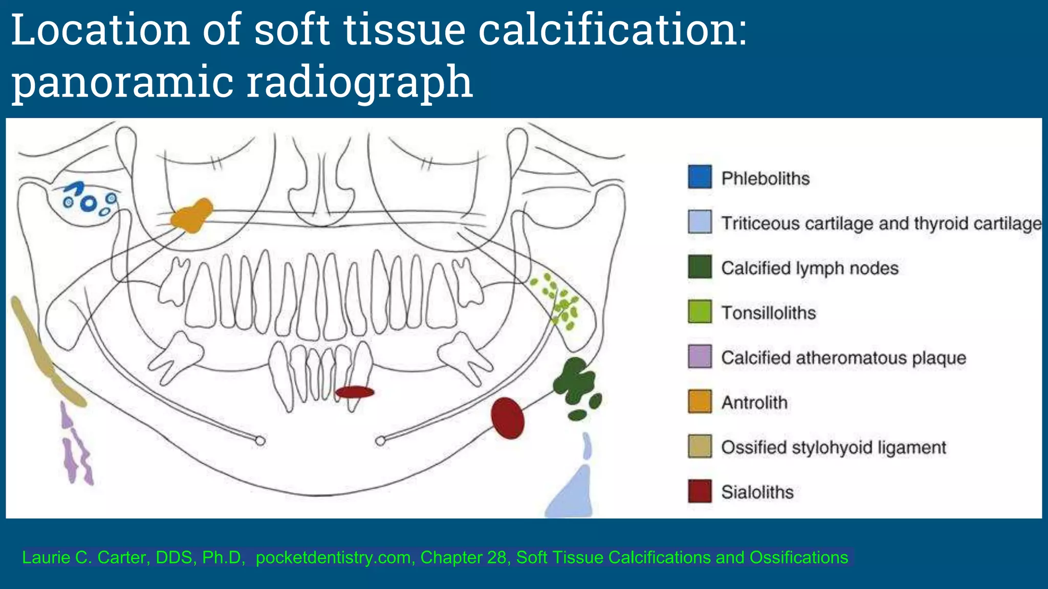 Soft tissue calcification in the neck | PPTX