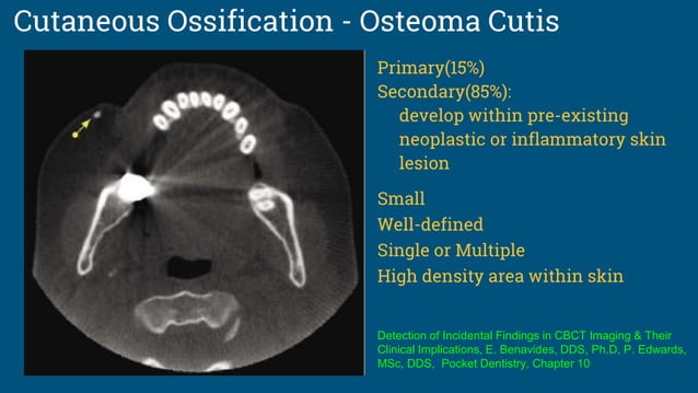 Soft tissue calcification in the neck | PPTX