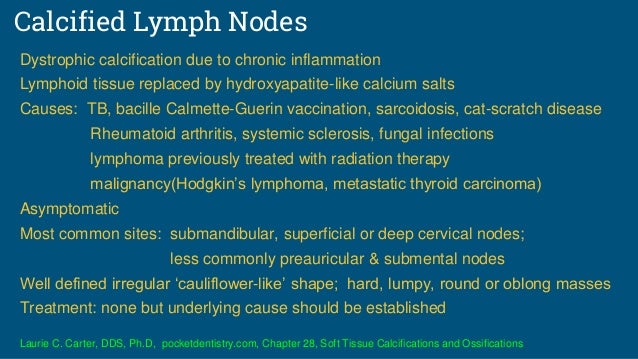Soft tissue calcification in the neck