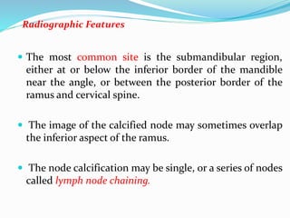 Soft tissue calcification of head and neck | PPTX
