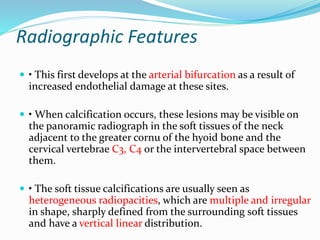 Soft tissue calcification of head and neck | PPTX