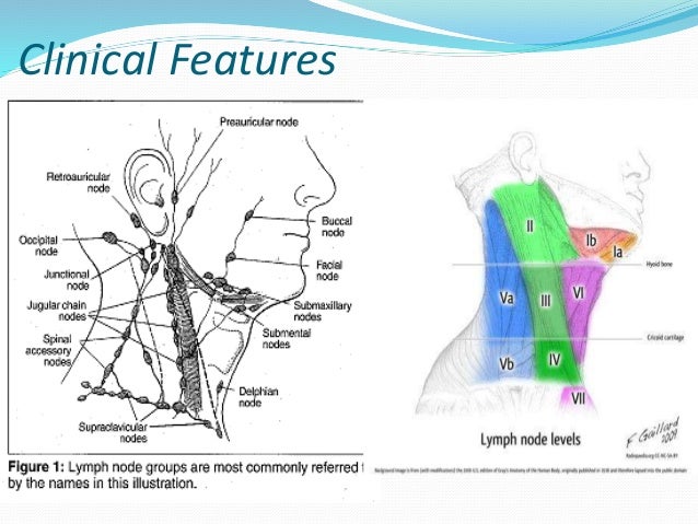 Soft tissue calcification of head and neck