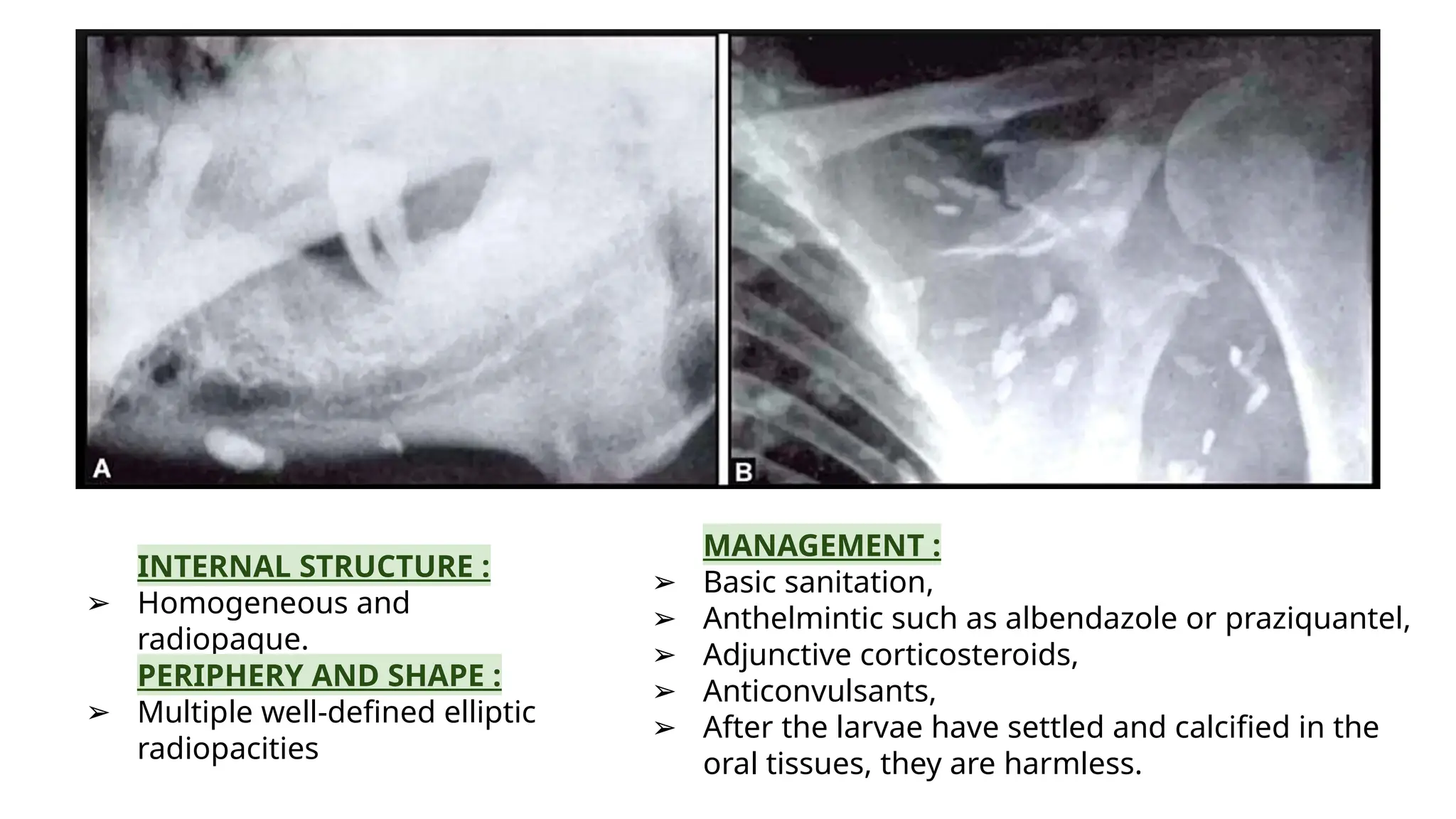 SOFT TISSUE CALCIFICATIONS - SHAIKA PARVEEN (2025).pptx
