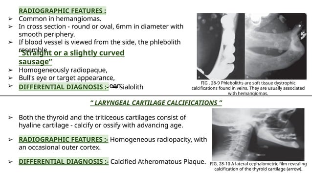 SOFT TISSUE CALCIFICATIONS - SHAIKA PARVEEN (2025).pptx