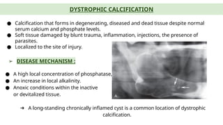 SOFT TISSUE CALCIFICATIONS - SHAIKA PARVEEN (2025).pptx
