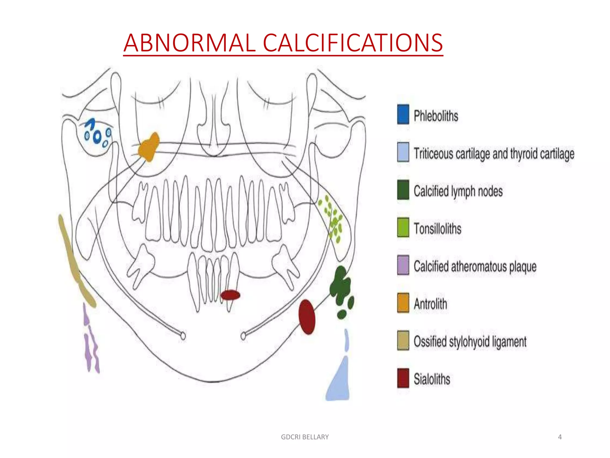 abnormal calcifications in head and neck region also with oral tissues ...