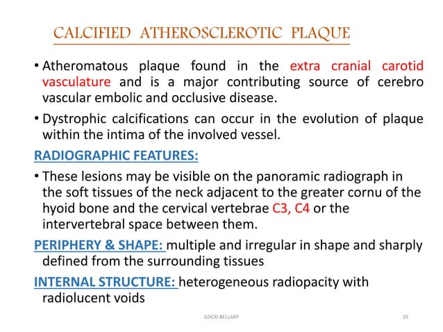 abnormal calcifications in head and neck region also with oral tissues ...