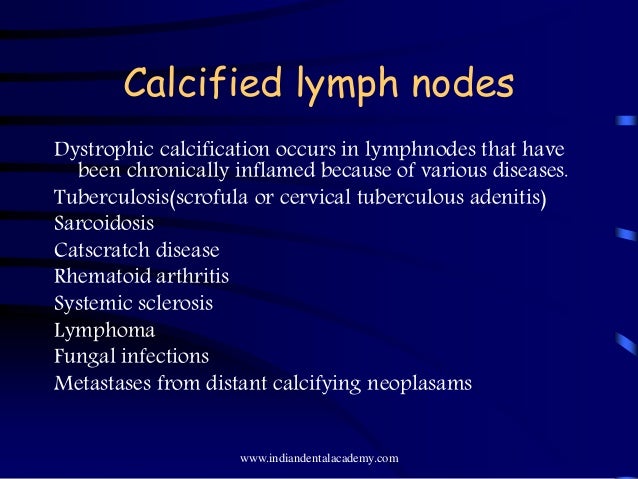 Calcified Lymph Nodes - Printable Cards