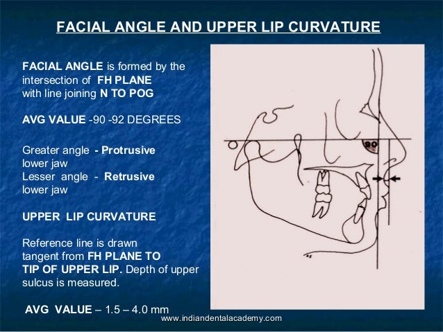 Soft tissue cephalometric analysis /certified fixed orthodontic cours…