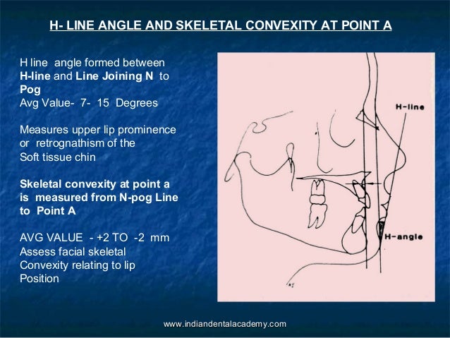 Soft tissue cephalometric analysis /certified fixed orthodontic cours…