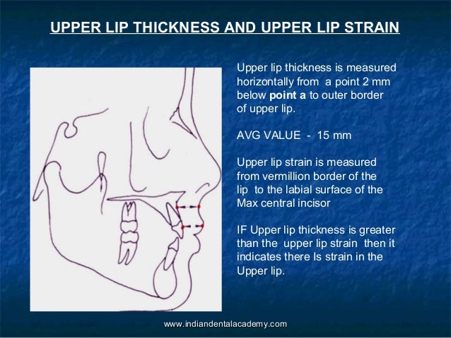 Soft tissue cephalometric analysis /certified fixed orthodontic cours…