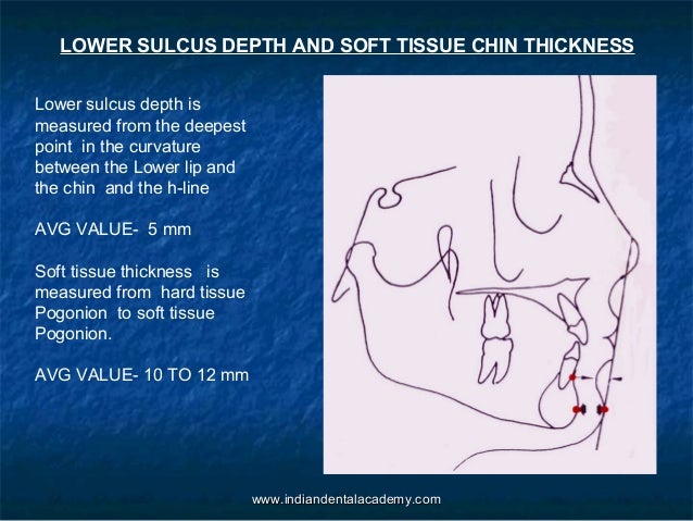 Soft tissue cephalometric analysis