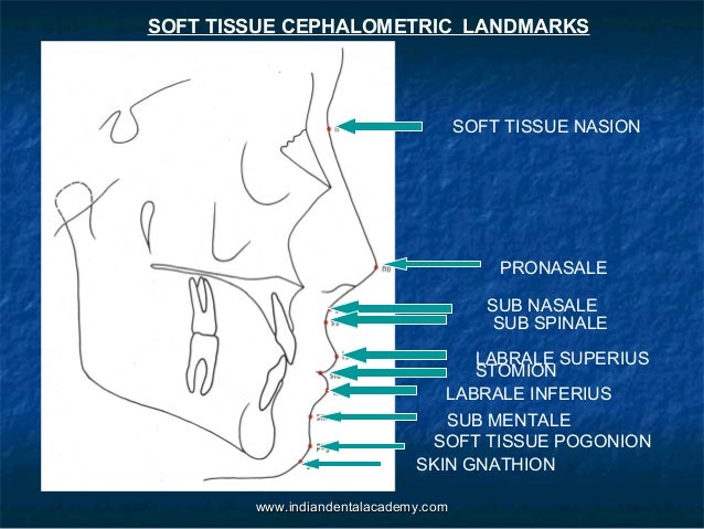 Soft tissue cephalometric analysis
