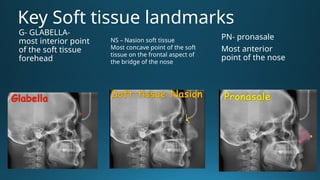 Soft tissue cephalometric analysis [Autosaved].pptx