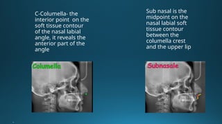 Soft tissue cephalometric analysis [Autosaved].pptx